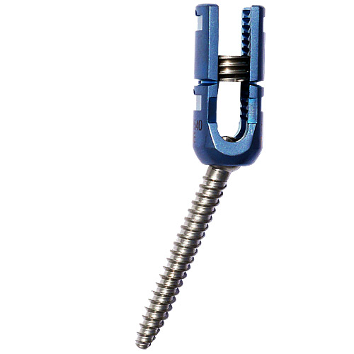Single Lock Monoaxial Screw Manufacturer & Supplier | India